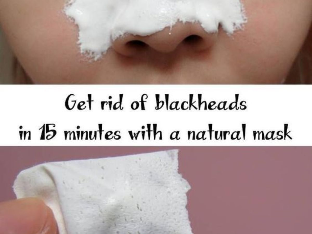 Inilah 3 Cara Membuat Masker Komedo dari Bahan Alami